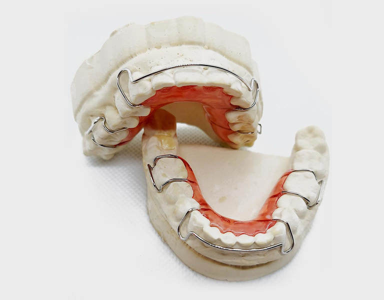 Dental Appliances - E&S Orthodontics