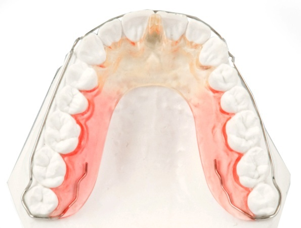 Dental Appliances - E&S Orthodontics