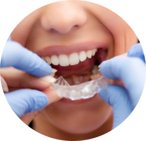 Orthodontics Retainers Near You | E&S Orthodontics
